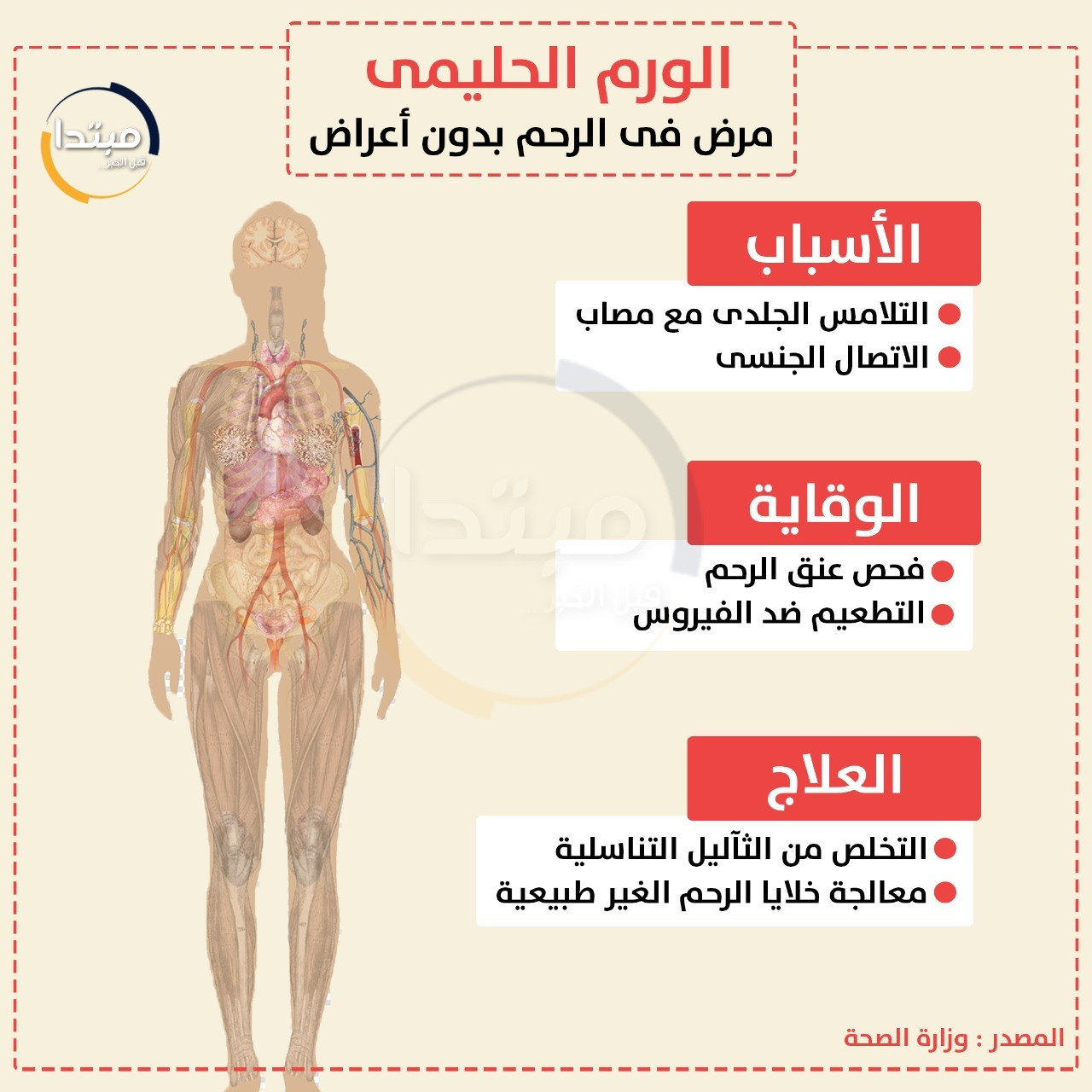 إنفوجراف: بعد إصابة روان بن حسين .. الورم الحليمى مرض فى الرحم بدون ...